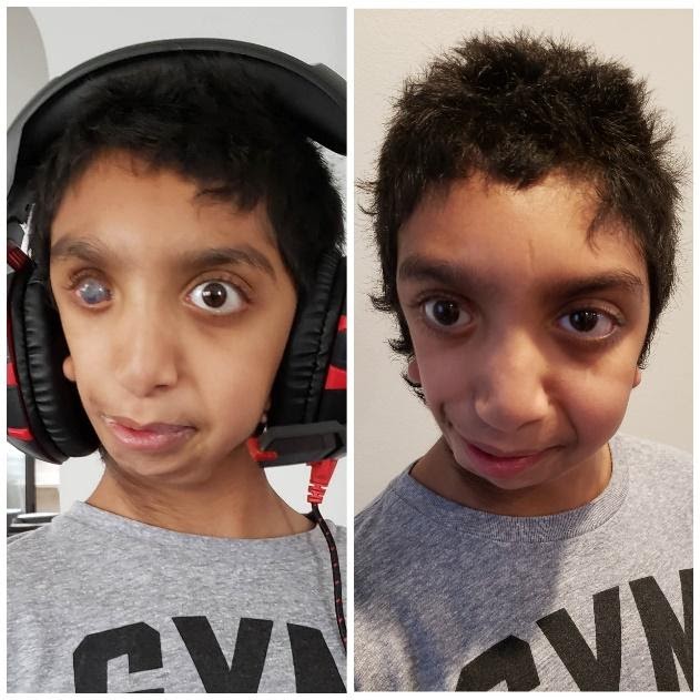 Craniofacial Introduction Letter to a new school - myFace