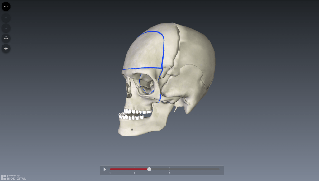 Monobloc Procedure – myFace