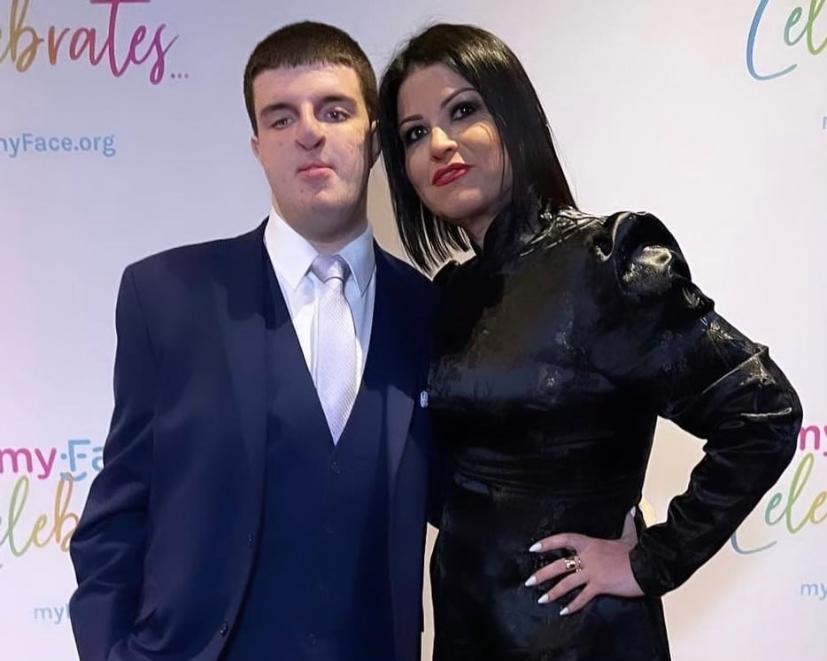 myFace, myStory: Taking Center Stage: A Mother and Son's Journey - myFace