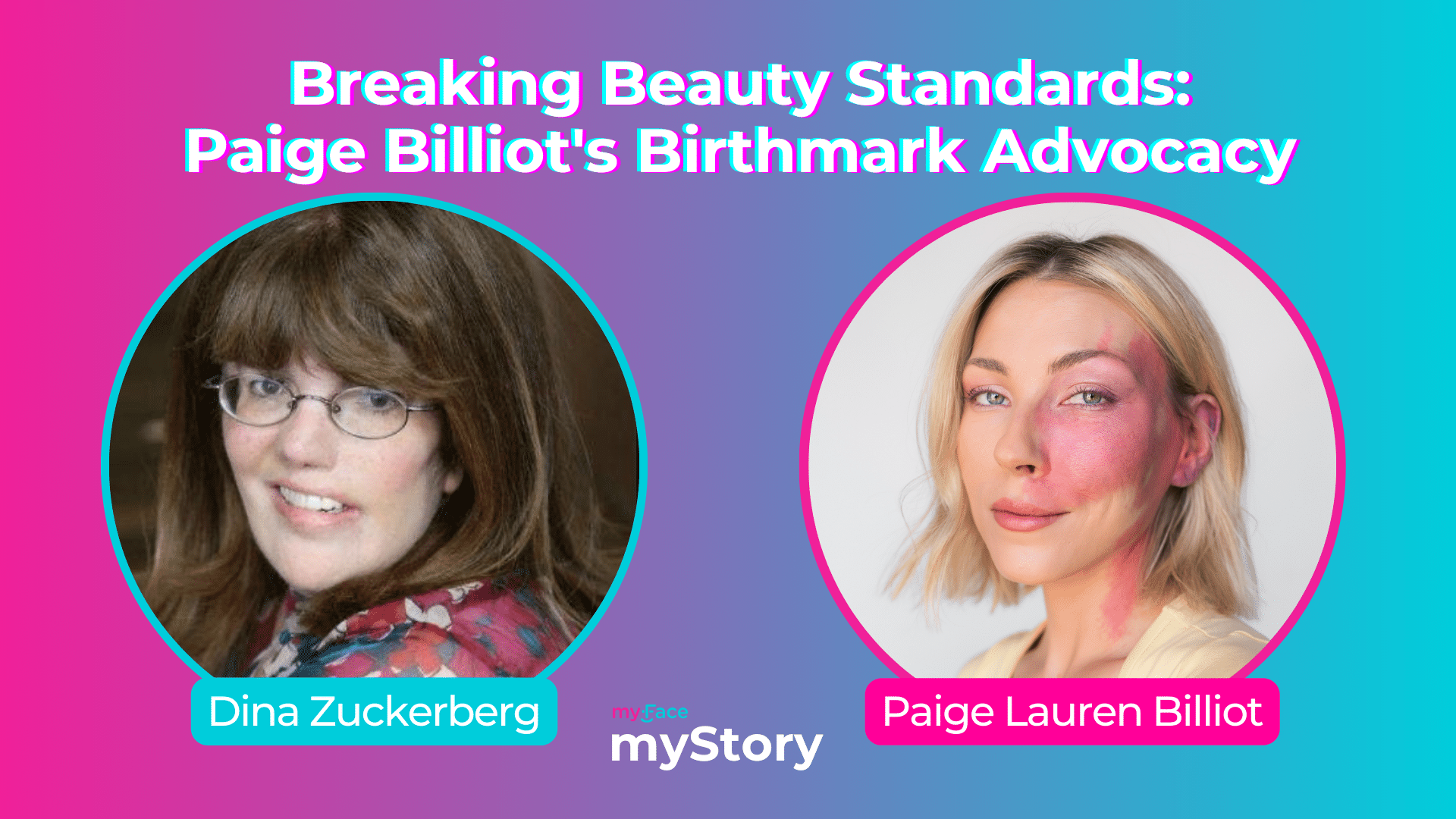 myFace, myStory: Breaking Beauty Standards: Paige Billiot's Birthmark ...